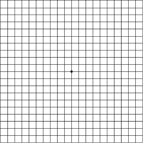 Macular Degeneration - EyeDentity Eyecare + Eyewear